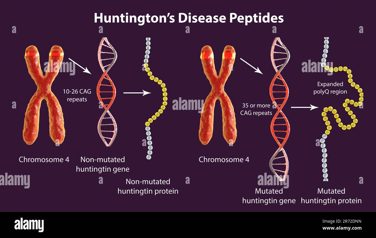 Molecular genesis of huntingtons disease hi-res stock photography and ...