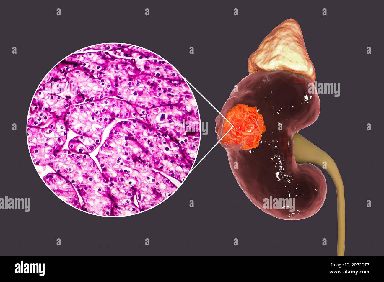 Lm light microscope hi-res stock photography and images - Alamy