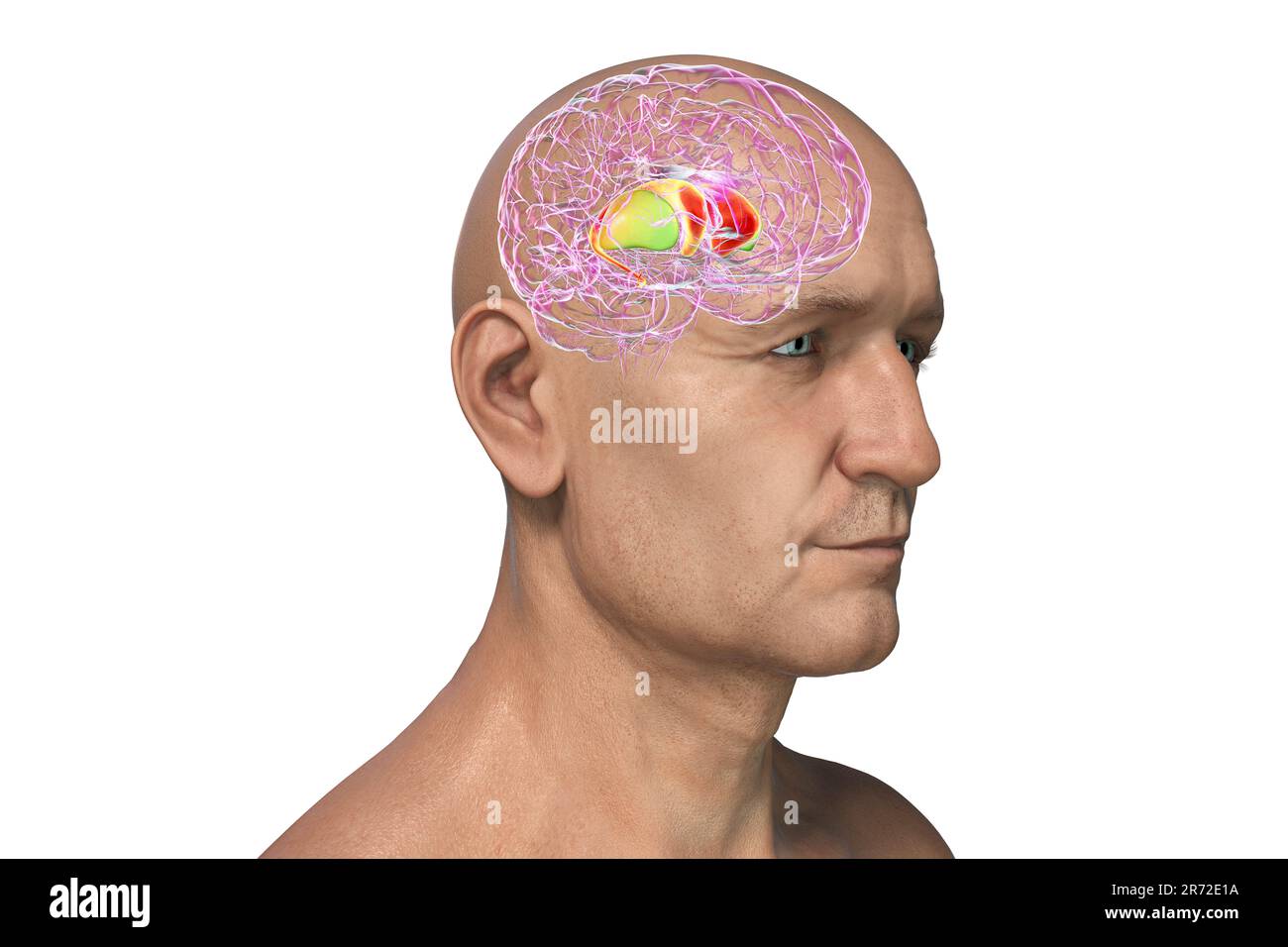 Dorsal striatum in the human brain, computer illustration. It is a ...