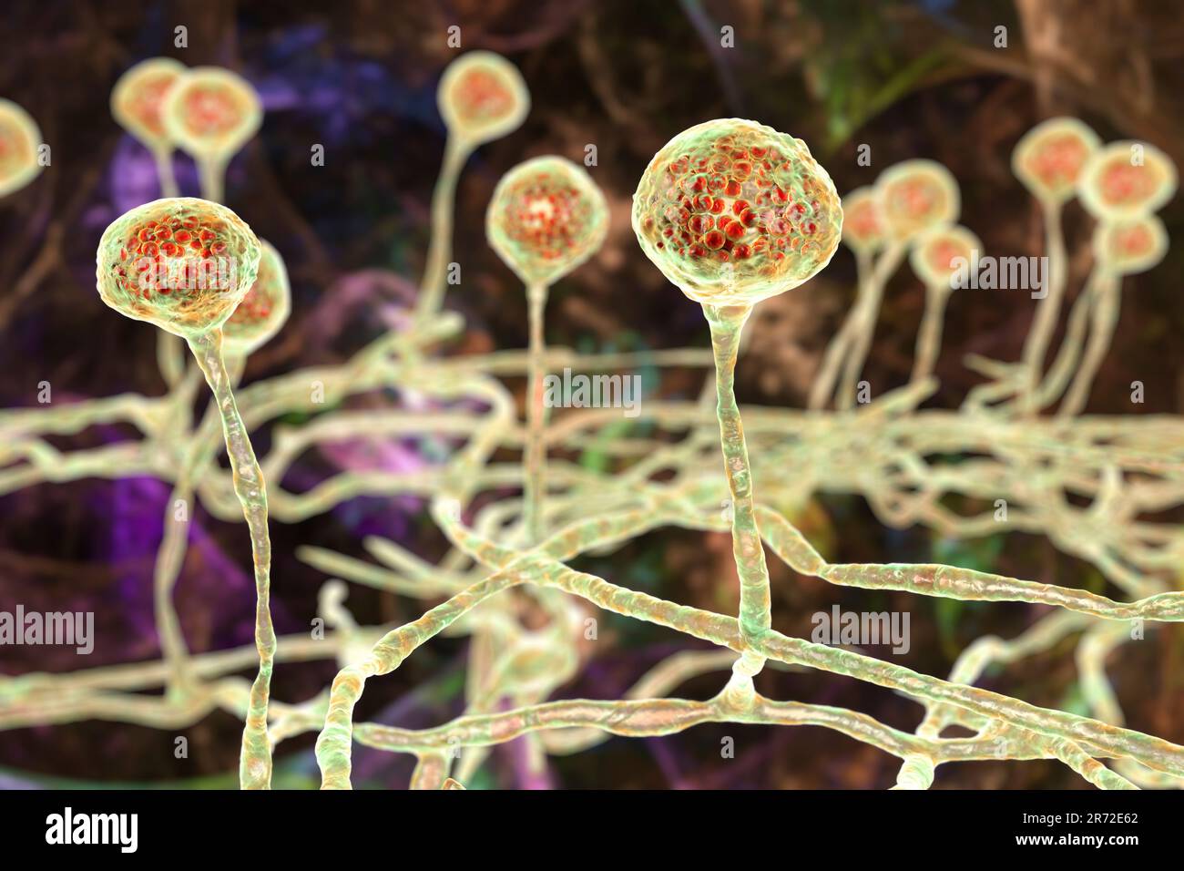 Mucor mold, also known as black fungus, bread mold fungi, computer ...