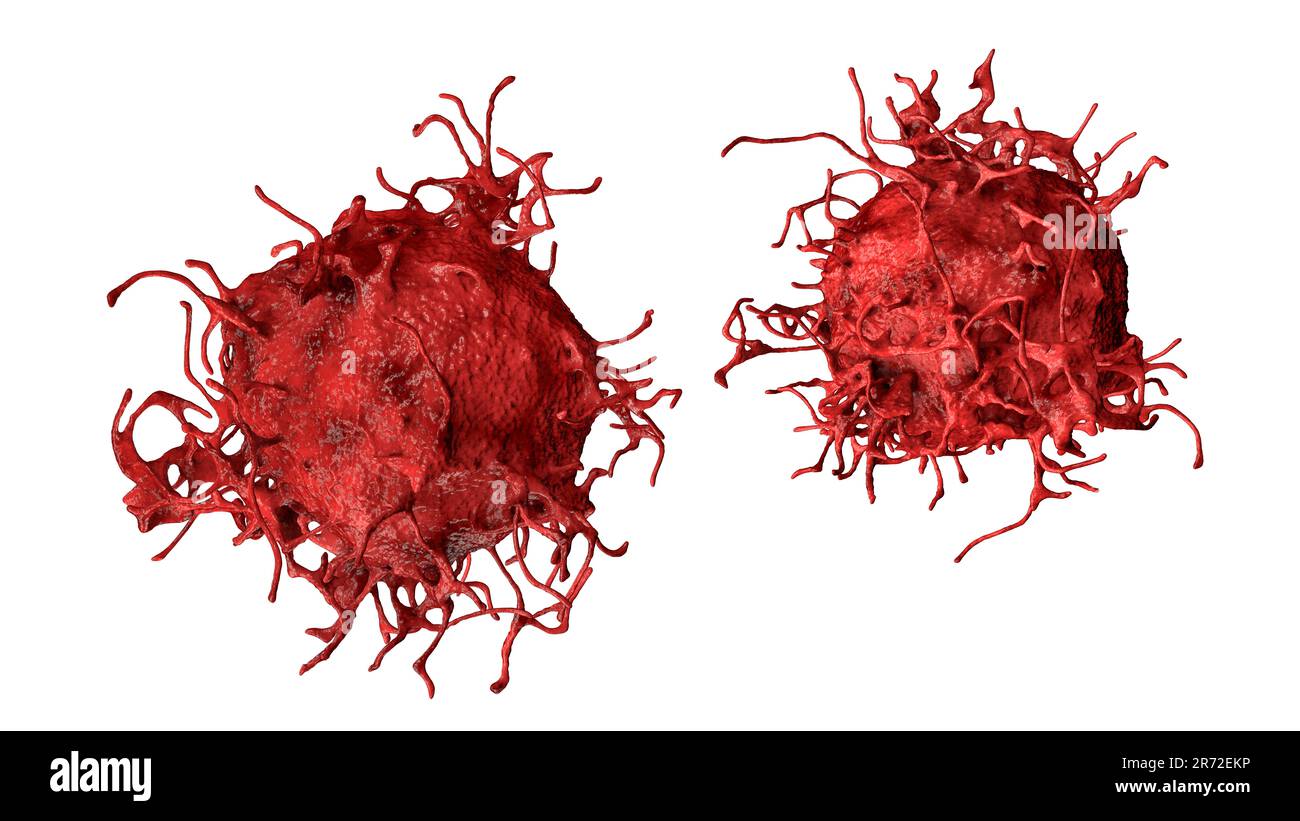 Skin cancer cell, computer artwork Stock Photo - Alamy