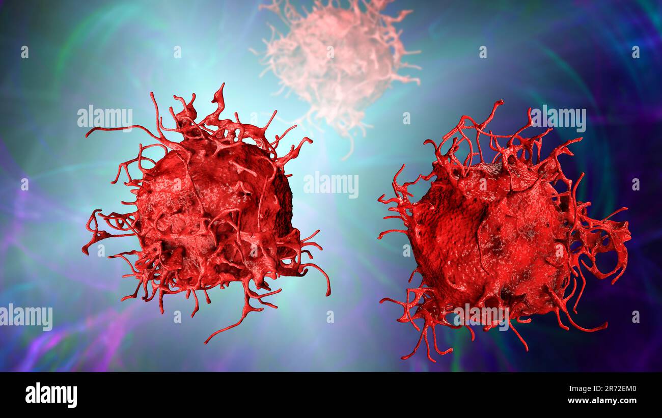 Skin cancer cell, computer artwork Stock Photo - Alamy