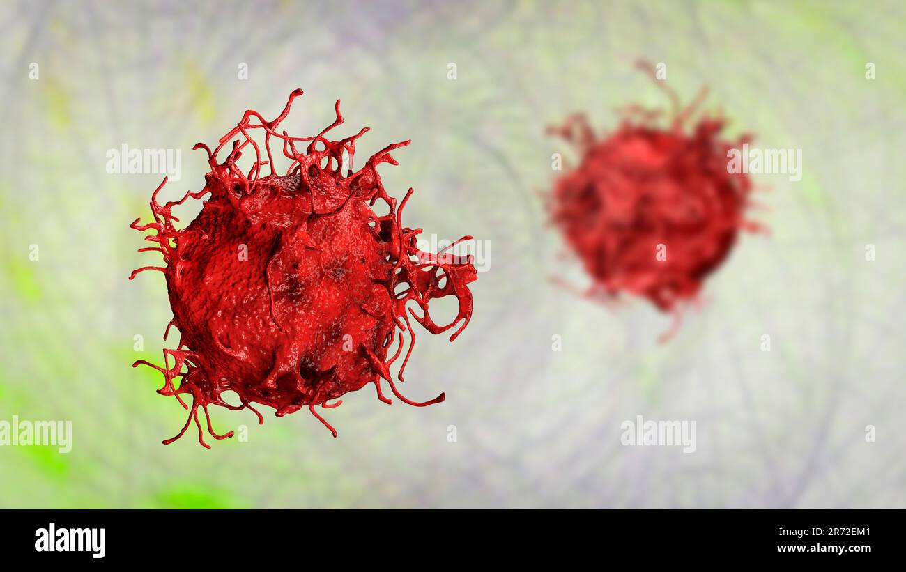 Skin cancer cell, computer artwork Stock Photo - Alamy