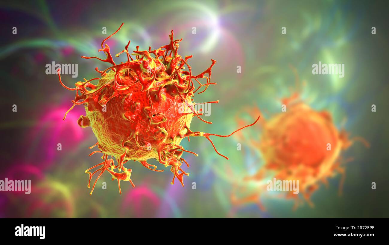 Skin cancer cell, computer artwork Stock Photo - Alamy