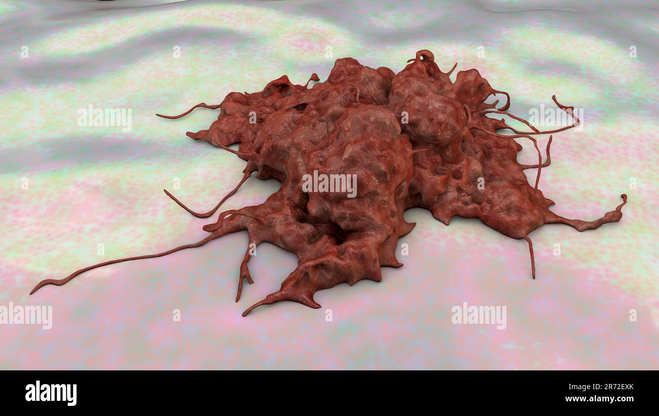 Cancer cell, computer illustration Stock Photo - Alamy