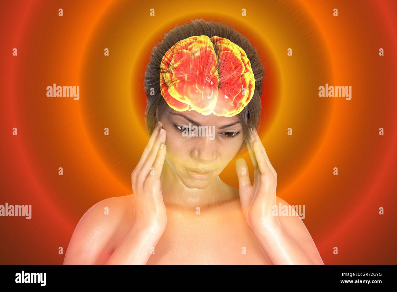 Headache, computer illustration Stock Photo - Alamy