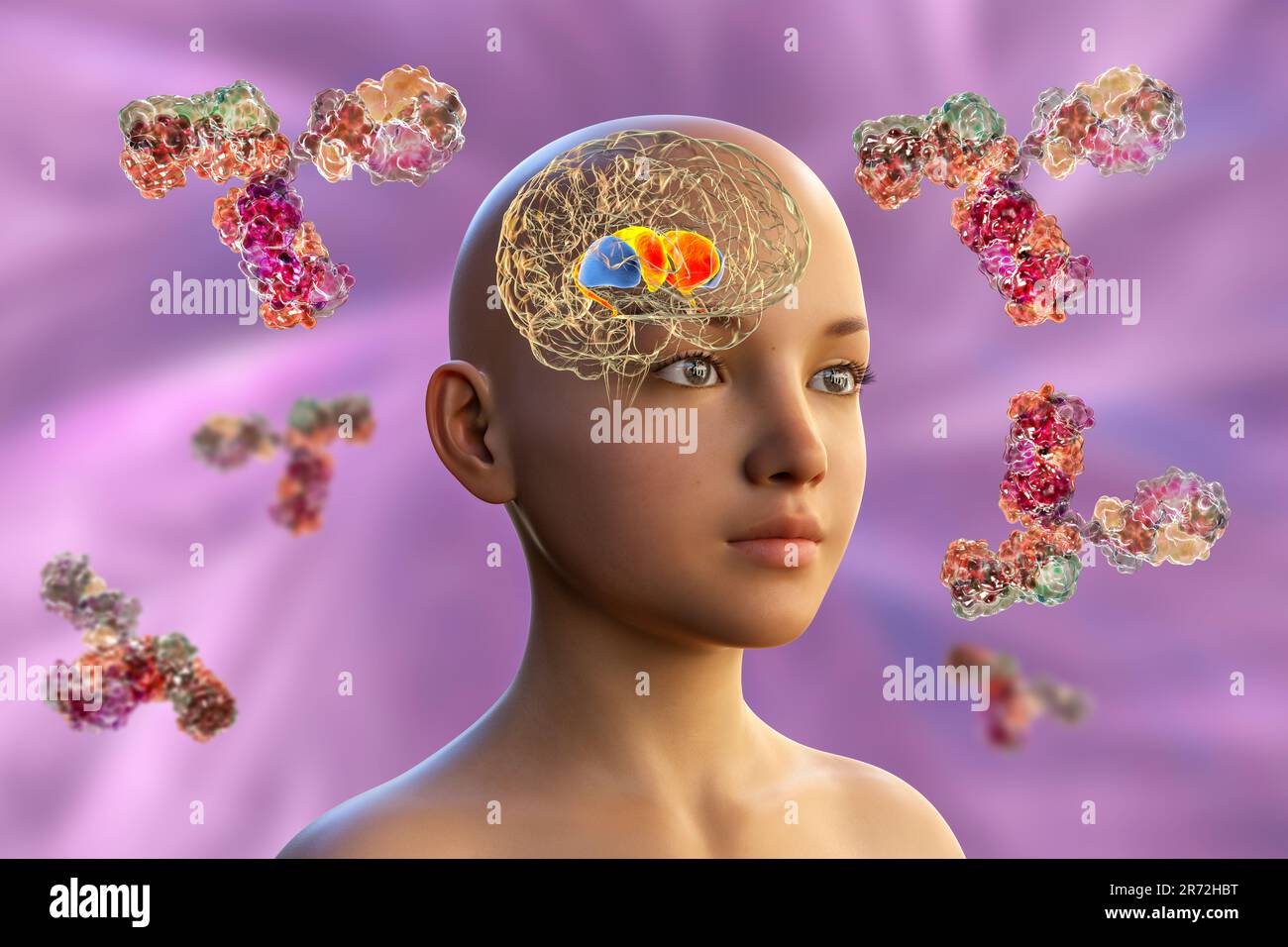 Anti-basal ganglia antibodies (ABGA). Conceptual computer illustration ...