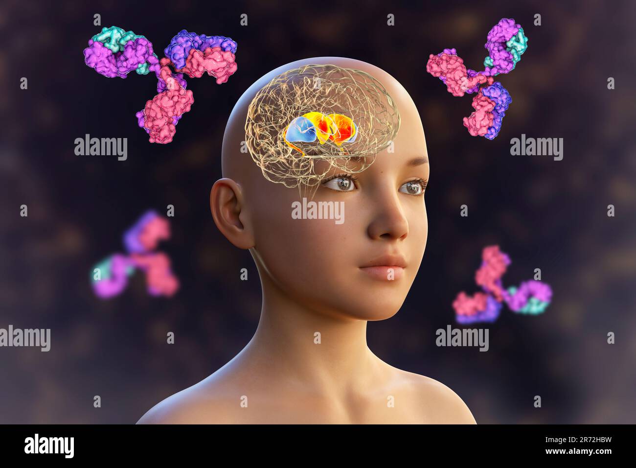 Anti-basal ganglia antibodies (ABGA). Conceptual computer illustration ...