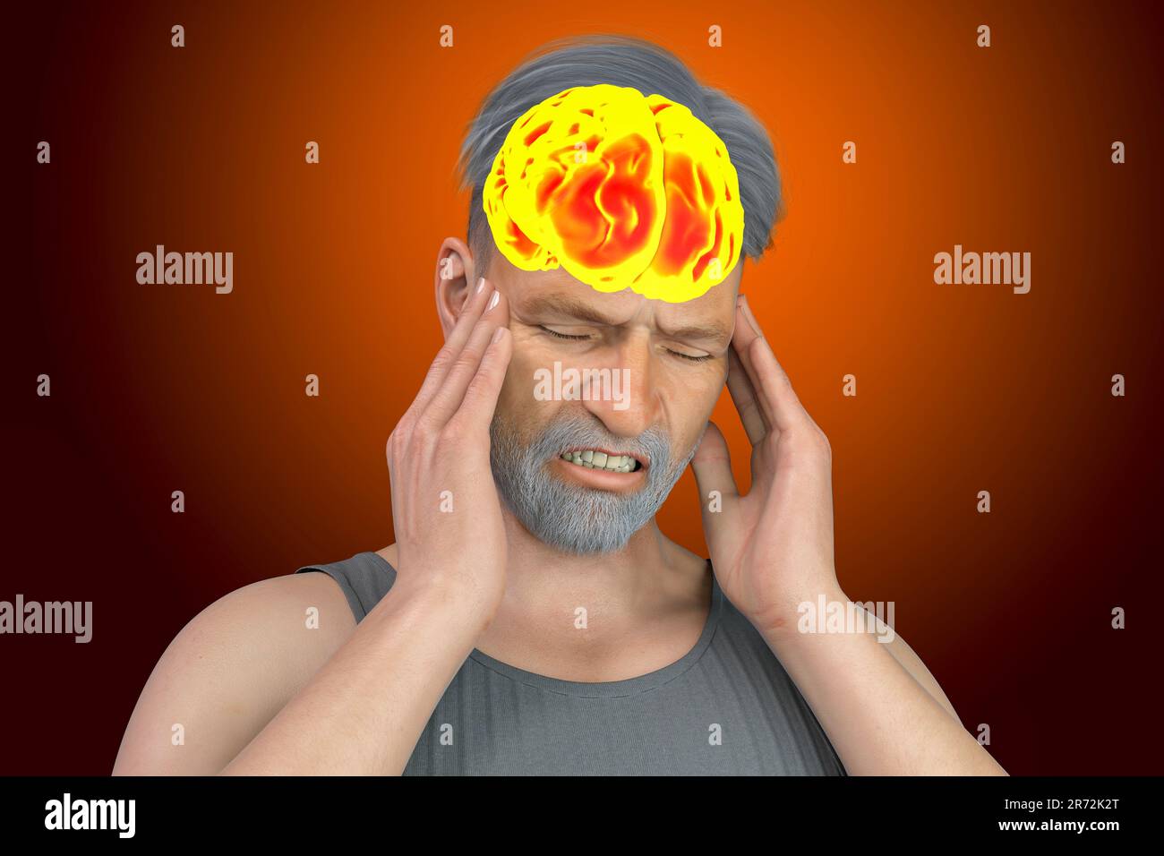 Headache, computer illustration Stock Photo - Alamy