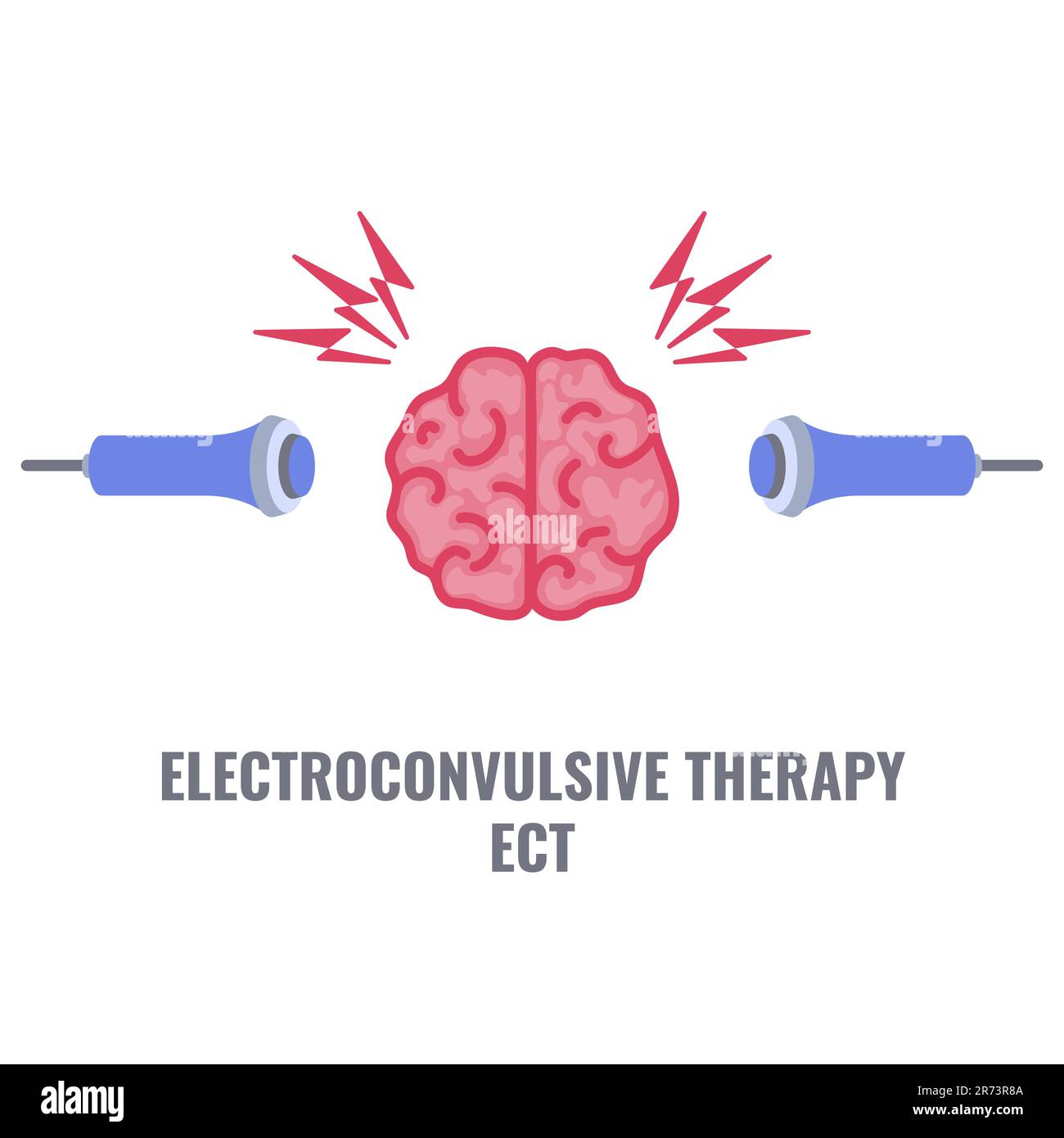 ECT electroconvulsive therapy for severe depression treatment Stock ...