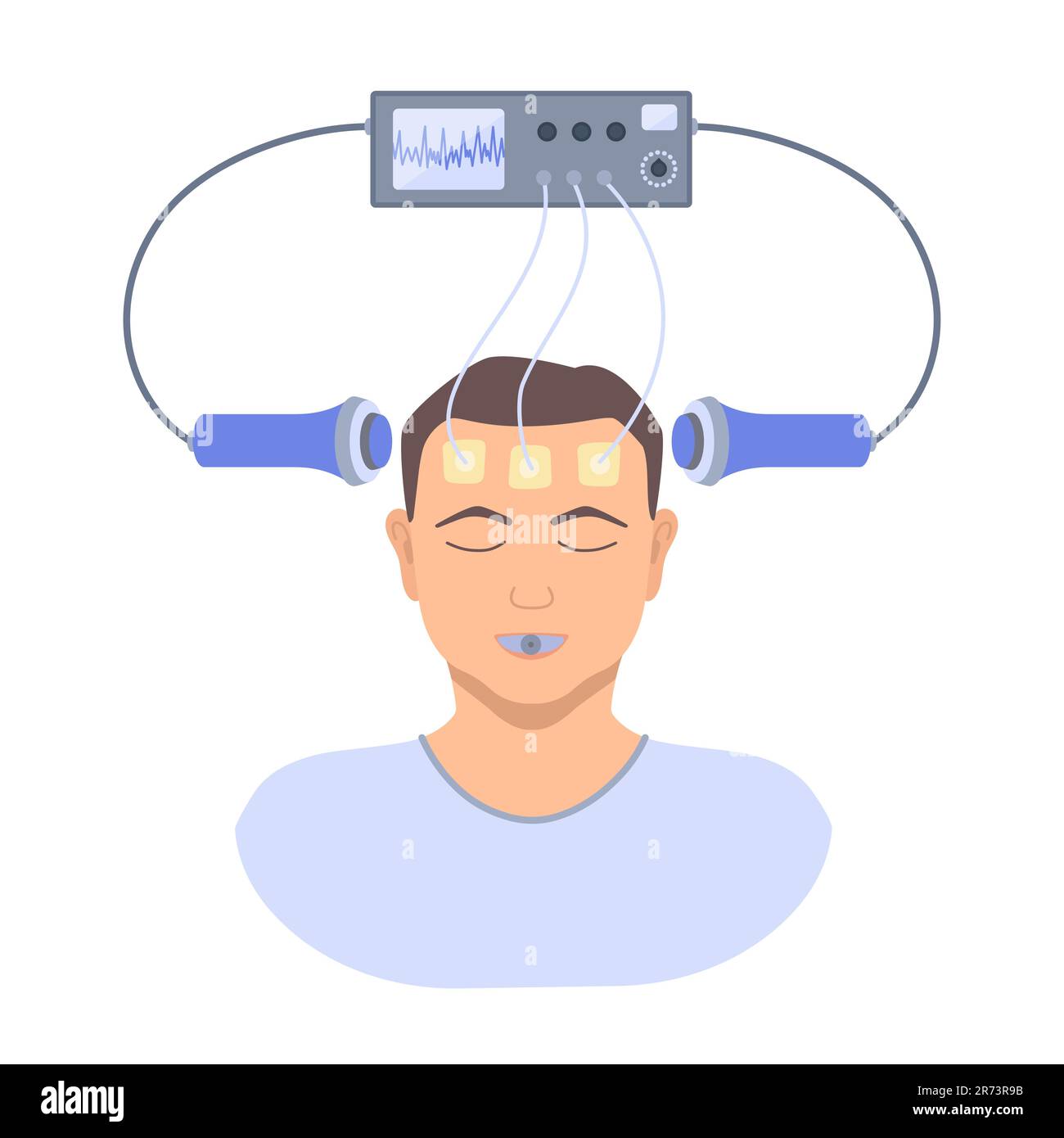 Electroconvulsive Shock Therapy