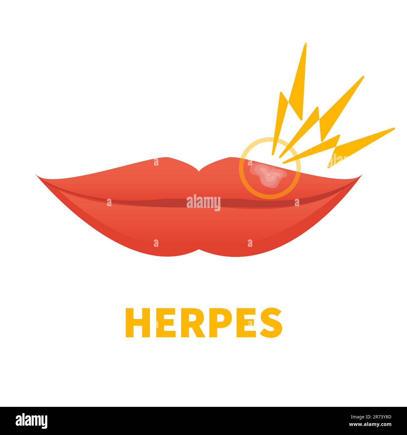 Burning lips Stock Vector Images - Alamy