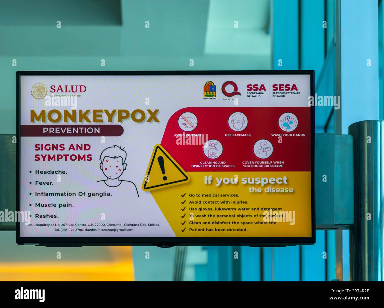 Electronic display information health advisory notice about MonkeyPox, Cancun airport, Mexico ...