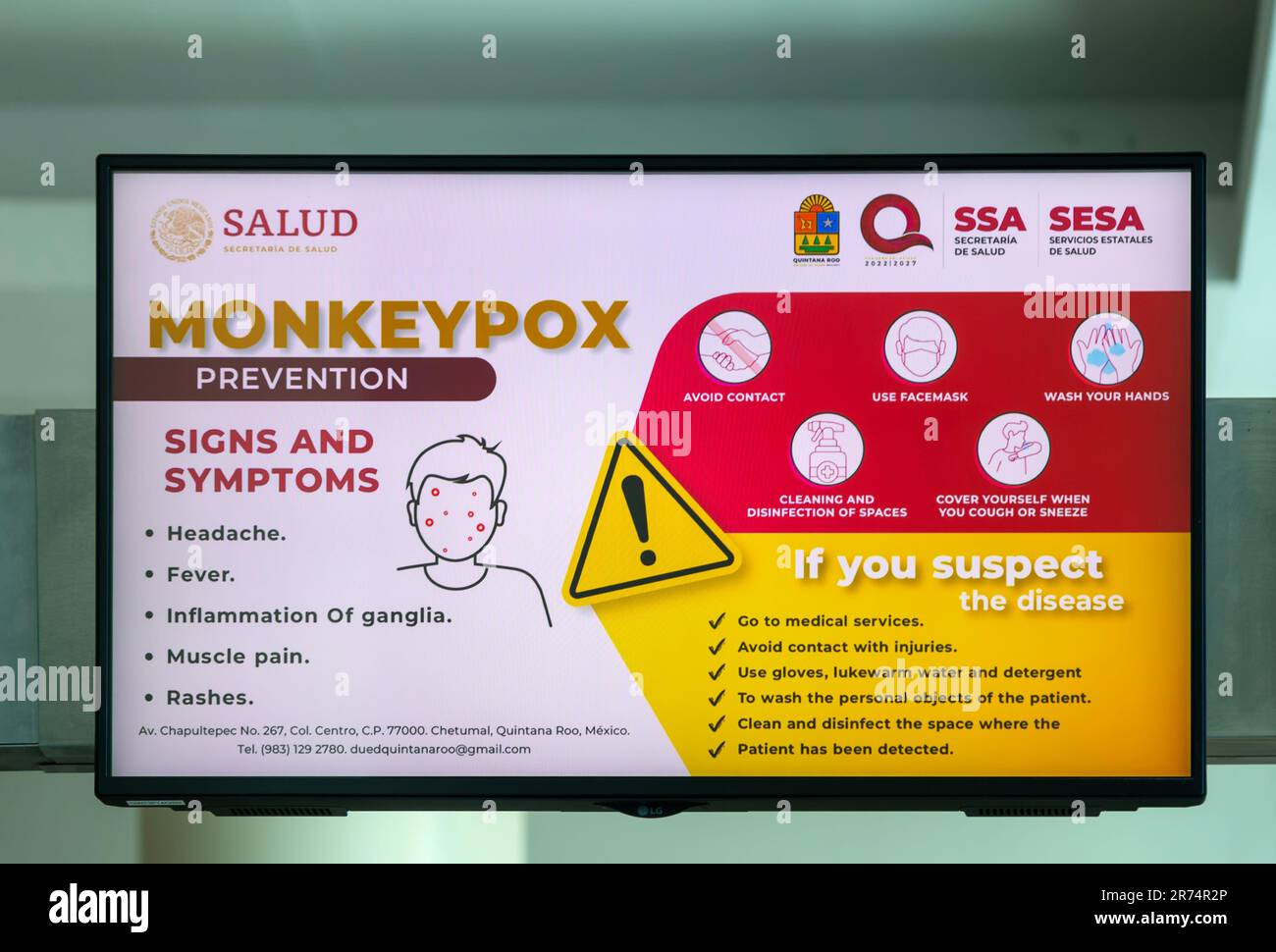 Electronic display information health advisory notice about MonkeyPox ...