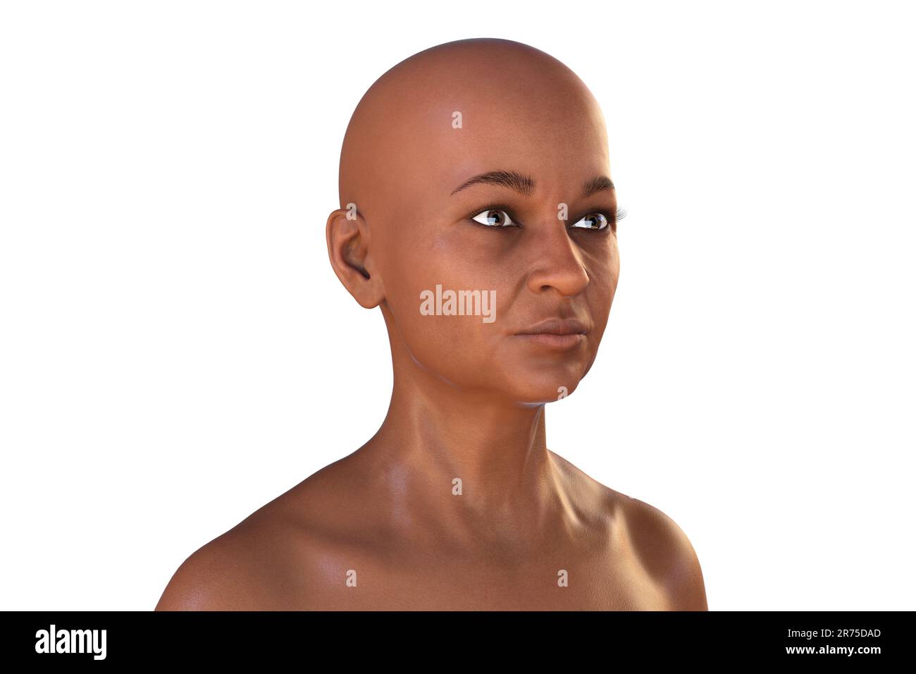 Portrait of a healthy dark skin woman without hair, computer artwork ...