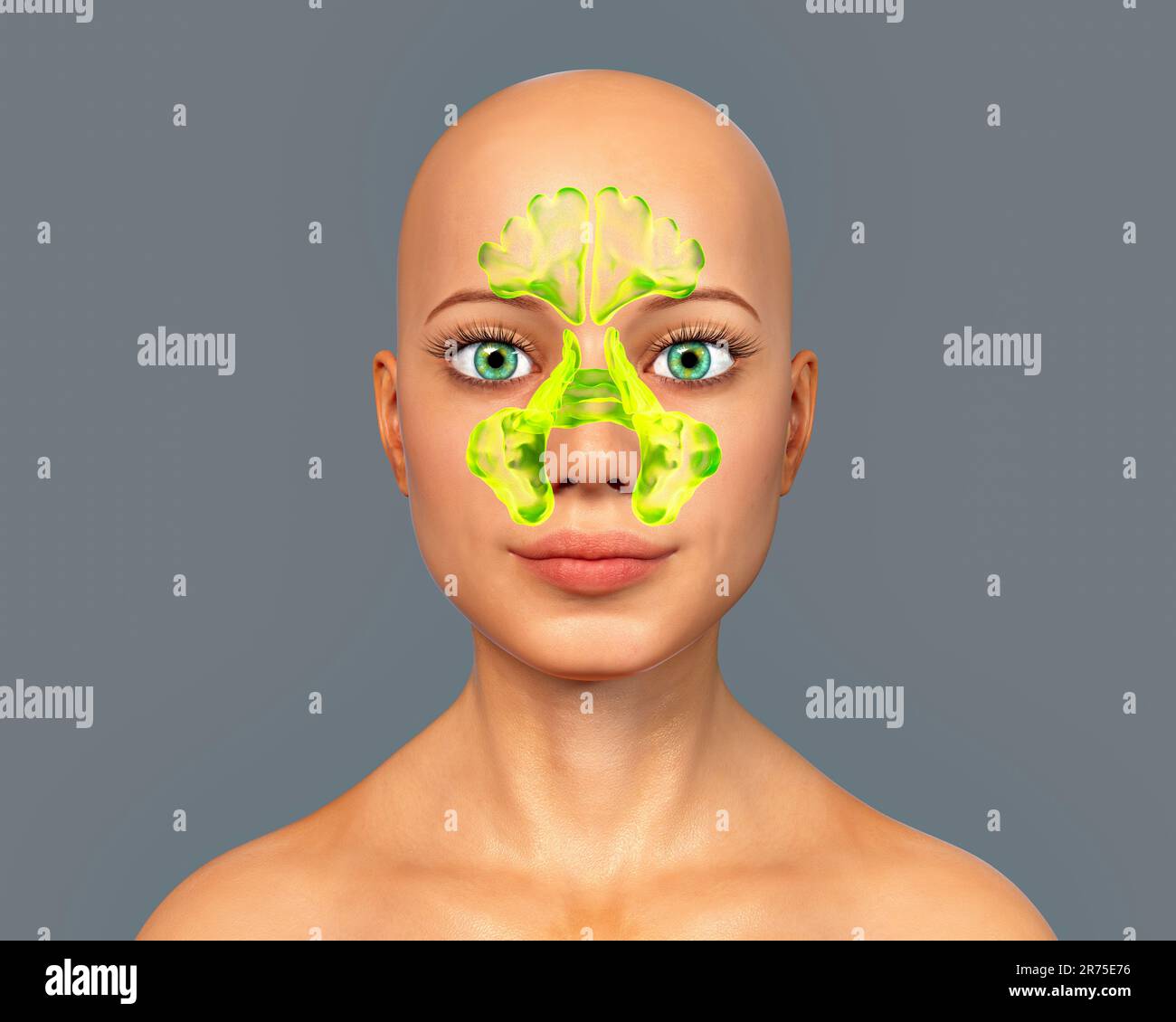 Human sinuses, computer illustration. The sinuses are membrane-lined ...