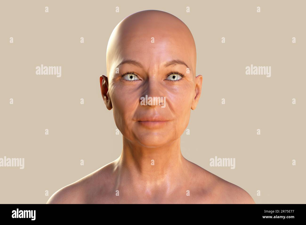 Portrait of a beautiful middle age woman without hair, computer ...