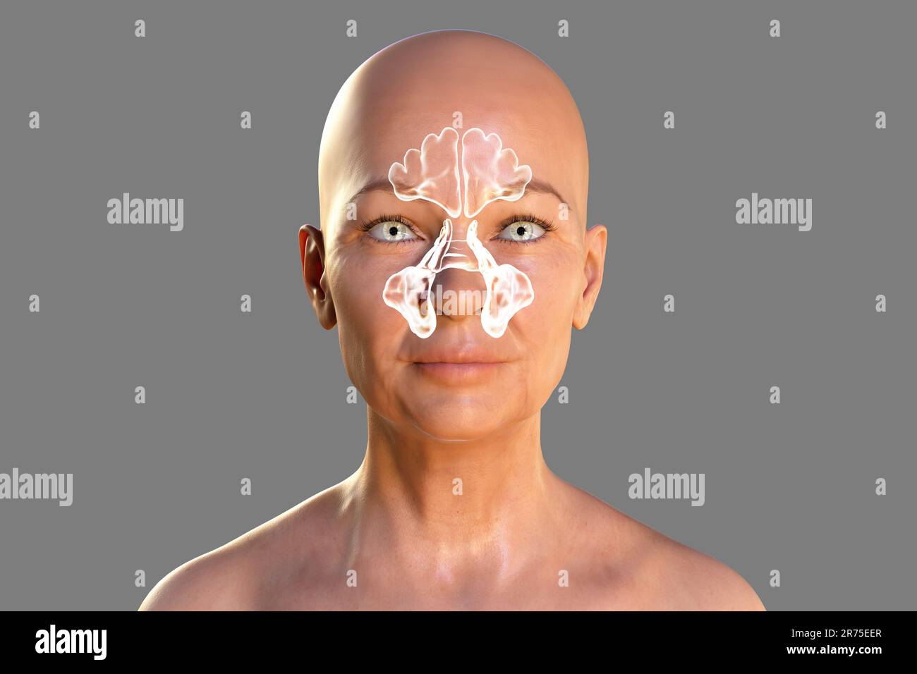 Human sinuses, computer illustration. The sinuses are membrane-lined ...