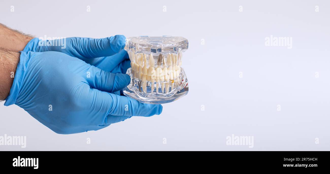Dental orthodontic dentistry teachng model with gums, tooth enamel ...