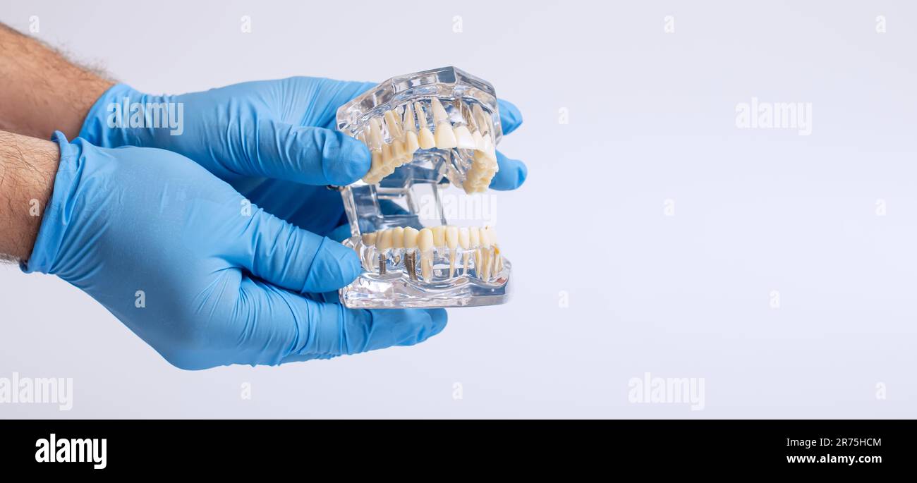 Dental orthodontic dentistry teachng model with gums, tooth enamel ...
