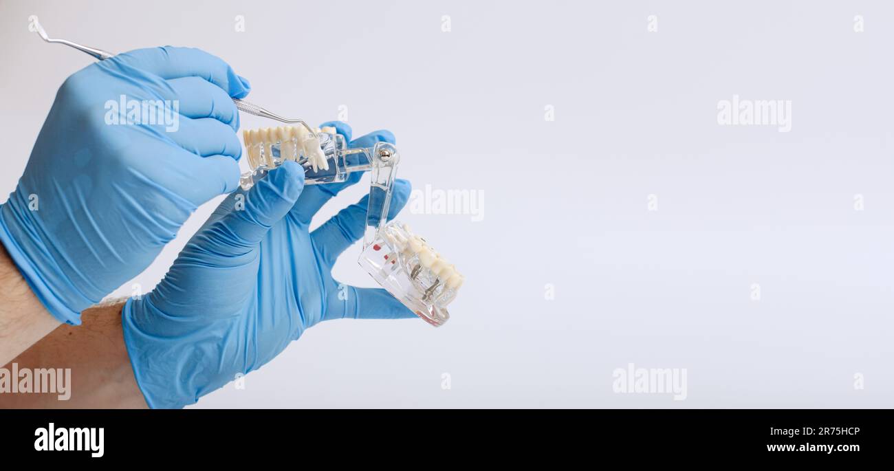 dentist shows the wisdom tooth on the training jaw, wisdom tooth ...