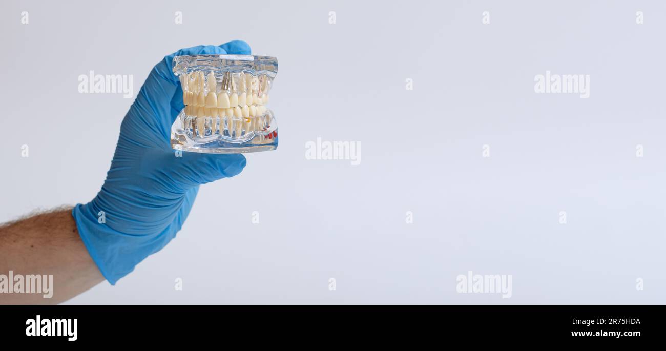 Dental orthodontic dentistry teachng model with gums, tooth enamel ...