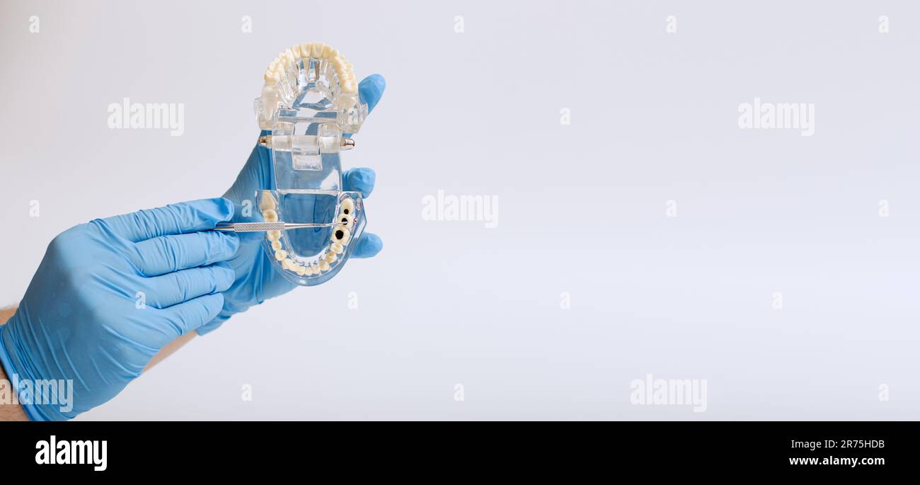 Plastic dental model holding hi-res stock photography and images - Alamy