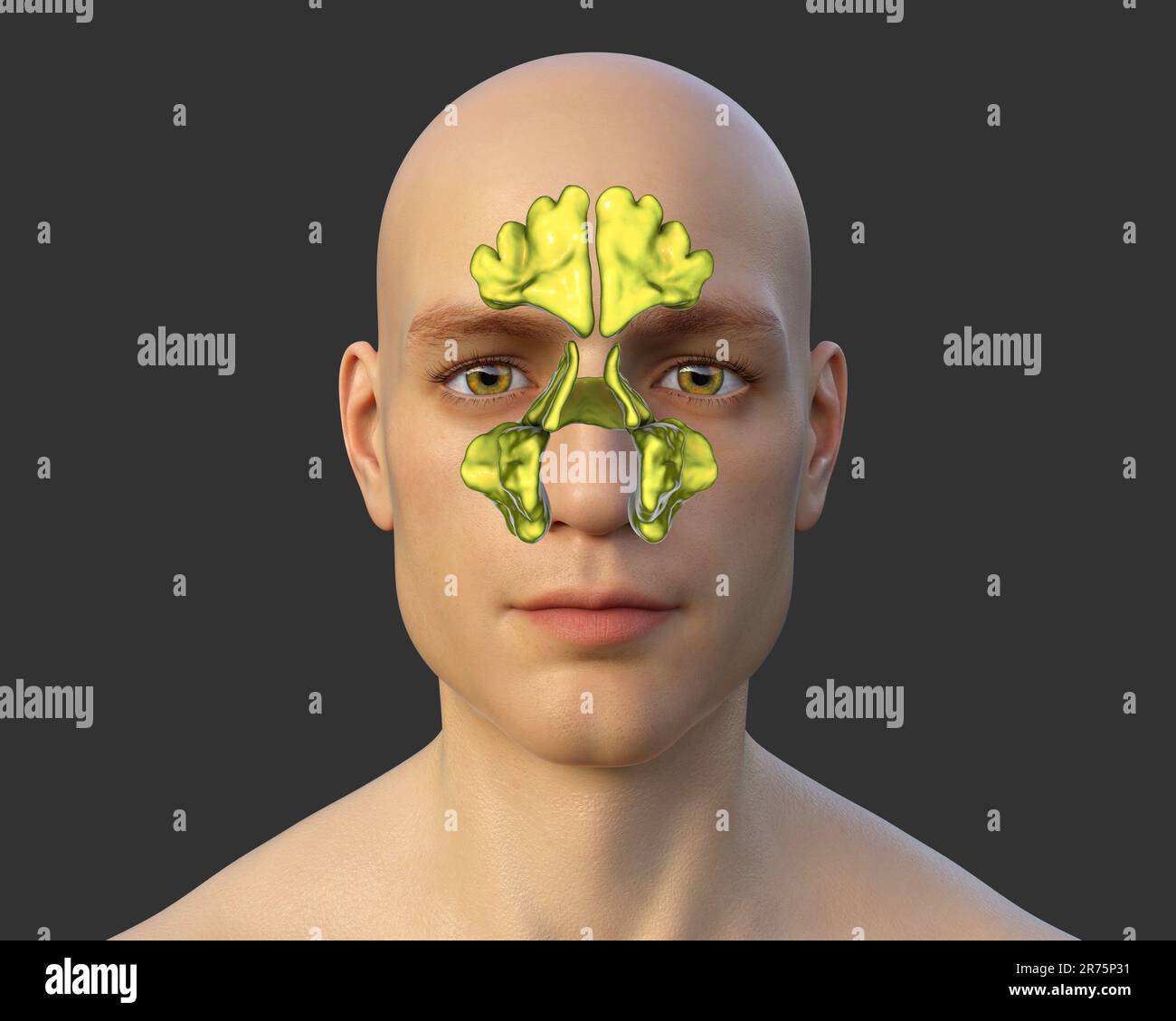 Human sinuses, computer illustration. The sinuses are membrane-lined ...