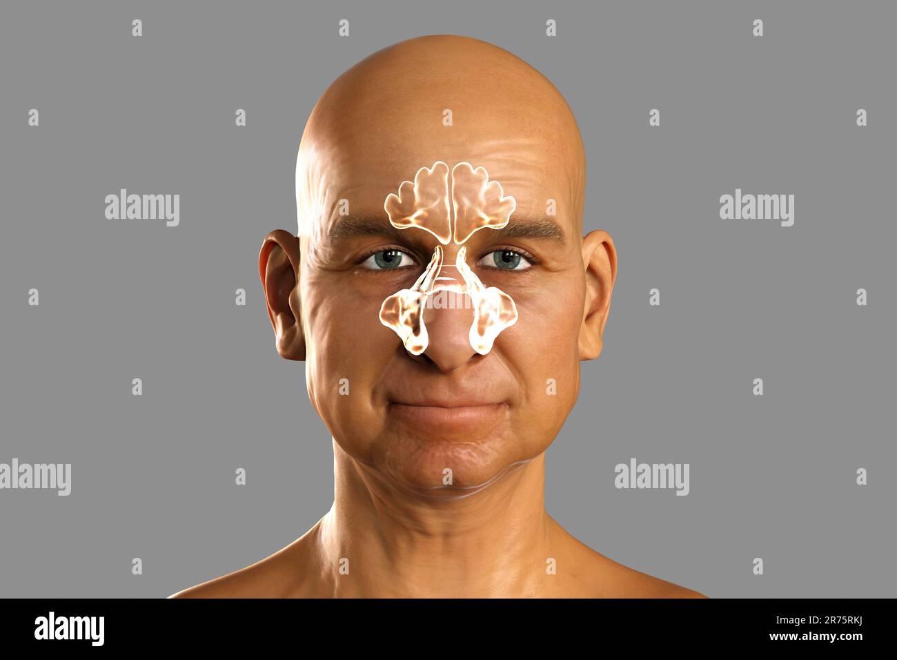 Human sinuses, computer illustration. The sinuses are membrane-lined ...