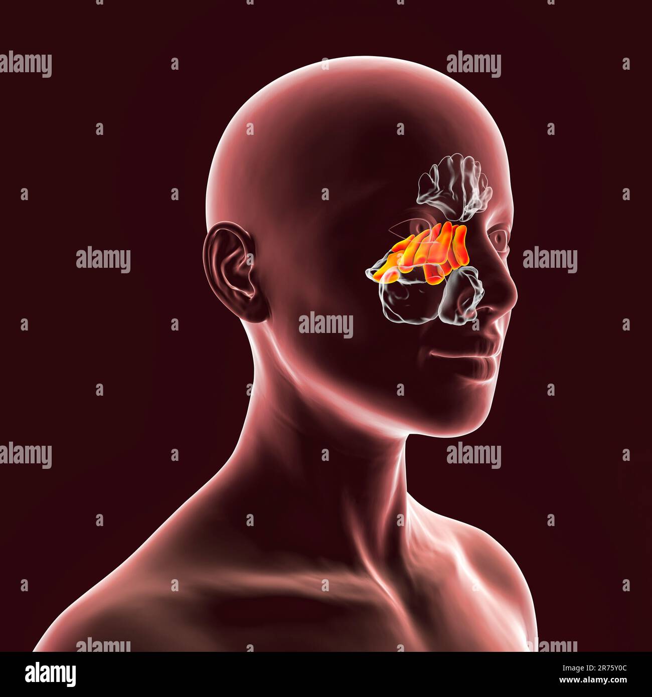 Facial Bones Of Paranasal Sinuses at Alexis Dawkins blog