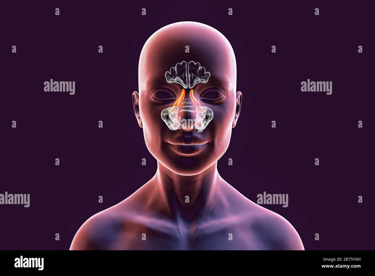 Human paranasal sinuses, computer illustration. The sinuses are ...