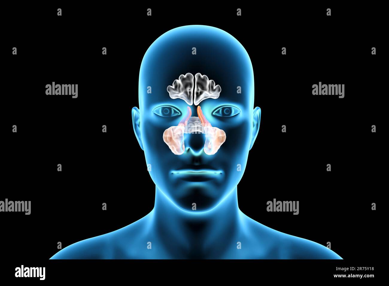 Human paranasal sinuses, computer illustration. The sinuses are ...
