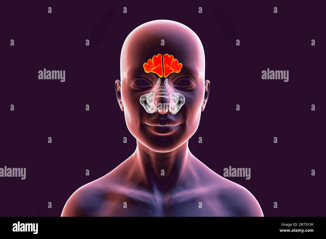 Human paranasal sinuses, computer illustration. The sinuses are ...