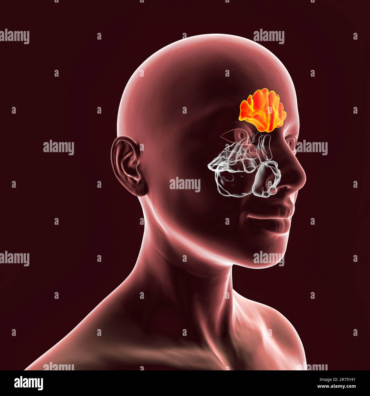 Human paranasal sinuses, computer illustration. The sinuses are ...