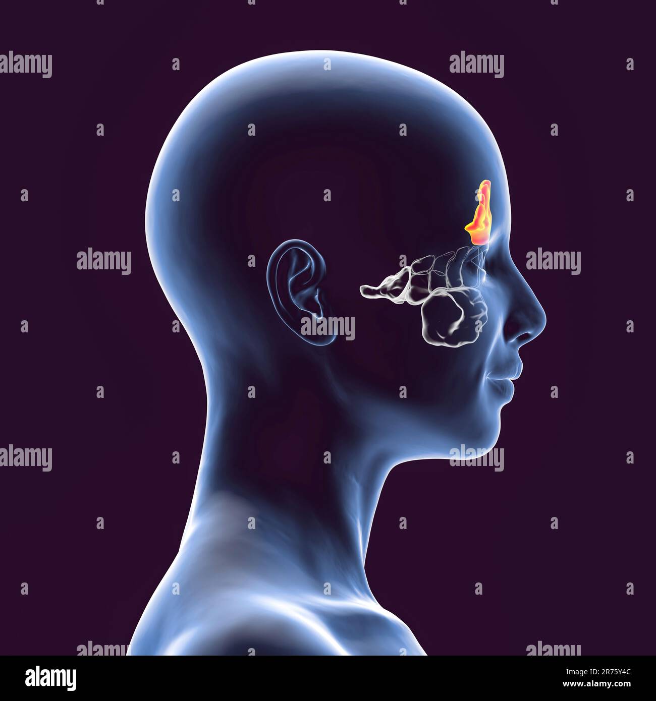 Human paranasal sinuses, computer illustration. The sinuses are ...