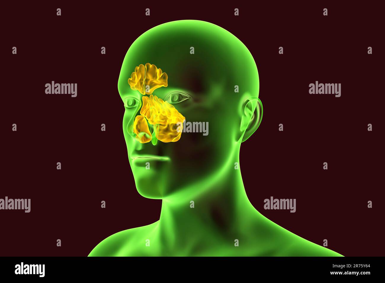 Human paranasal sinuses, computer illustration. The sinuses are ...