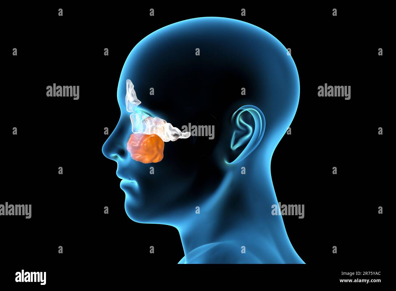 Human paranasal sinuses, computer illustration. The sinuses are ...