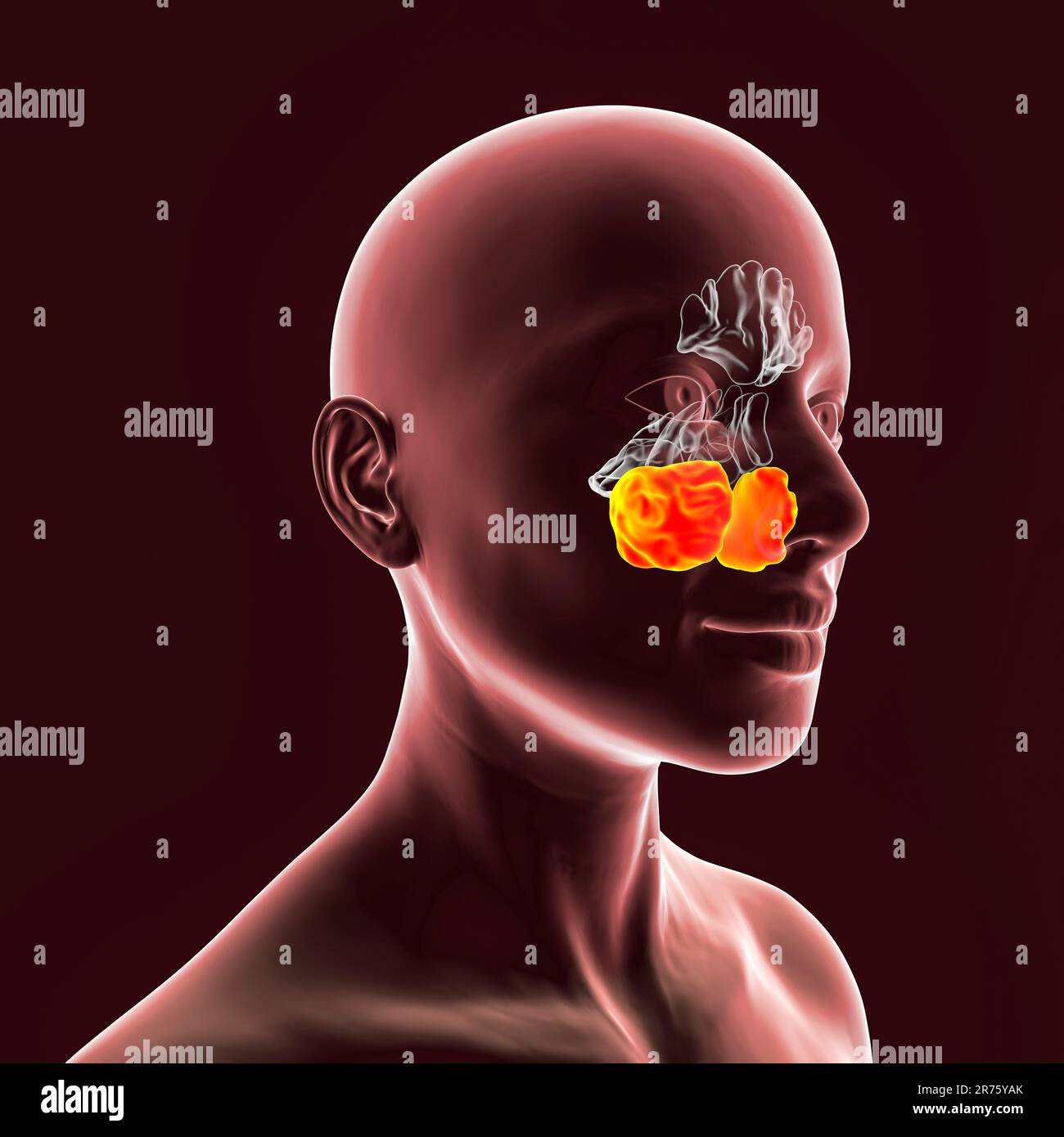 Human paranasal sinuses, computer illustration. The sinuses are ...