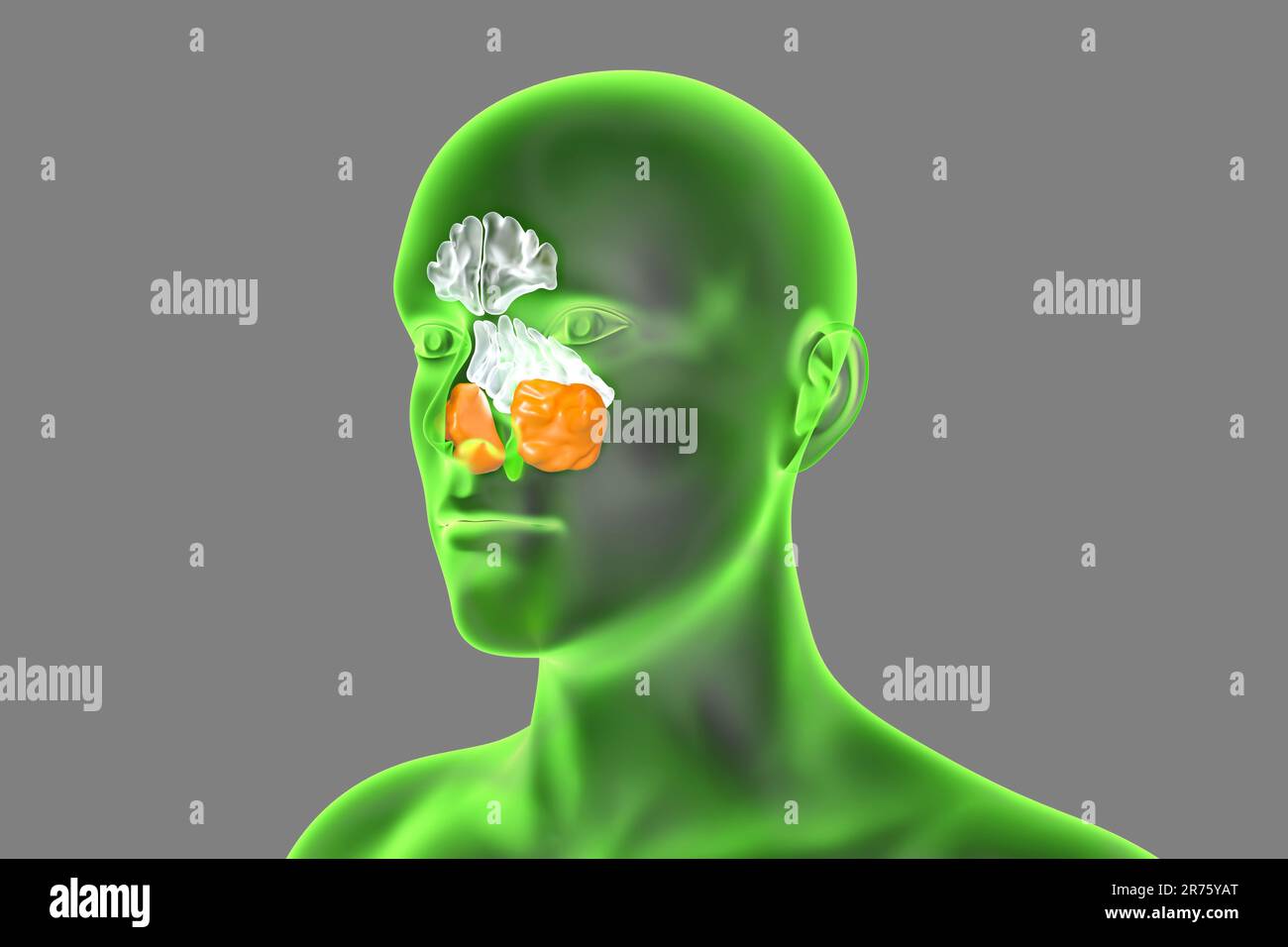 Human paranasal sinuses, computer illustration. The sinuses are ...