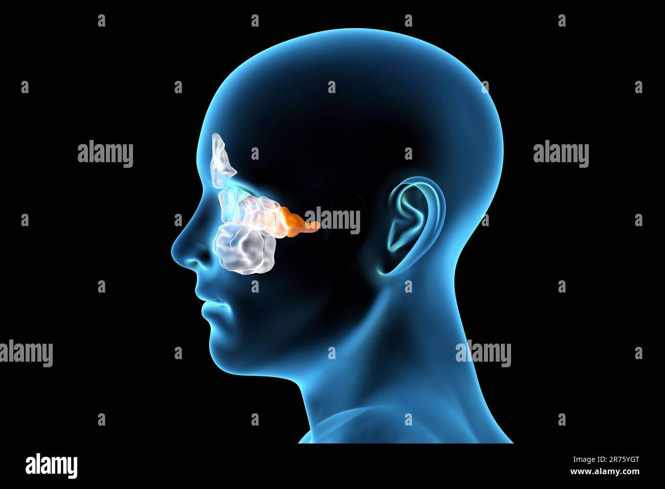 Human paranasal sinuses, computer illustration. The sinuses are ...