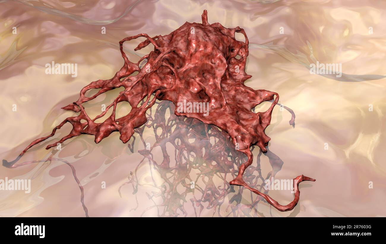 Cancer cell growing and spreading into surrounding tissues, computer ...
