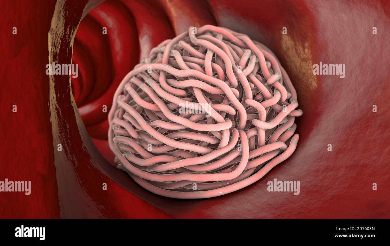 Roundworms Are What Type Of Biohazard Pathogenic Bacteria at Orville ...