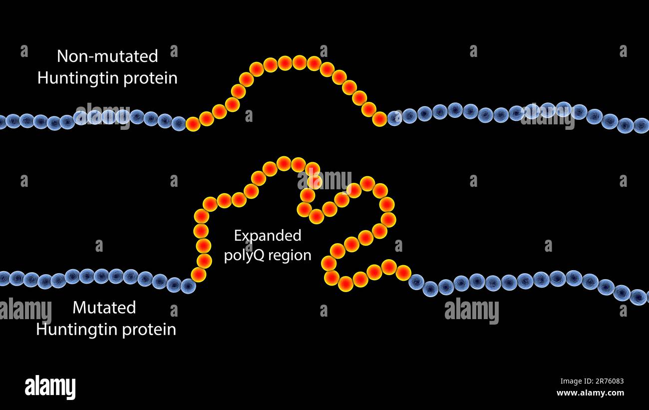 Healthy And Mutant Huntingtin Protein Sequence Computer Illustration Expansion Of The Cag