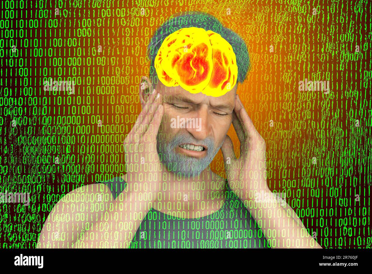Headache due to brain overload, conceptual computer illustration Stock ...