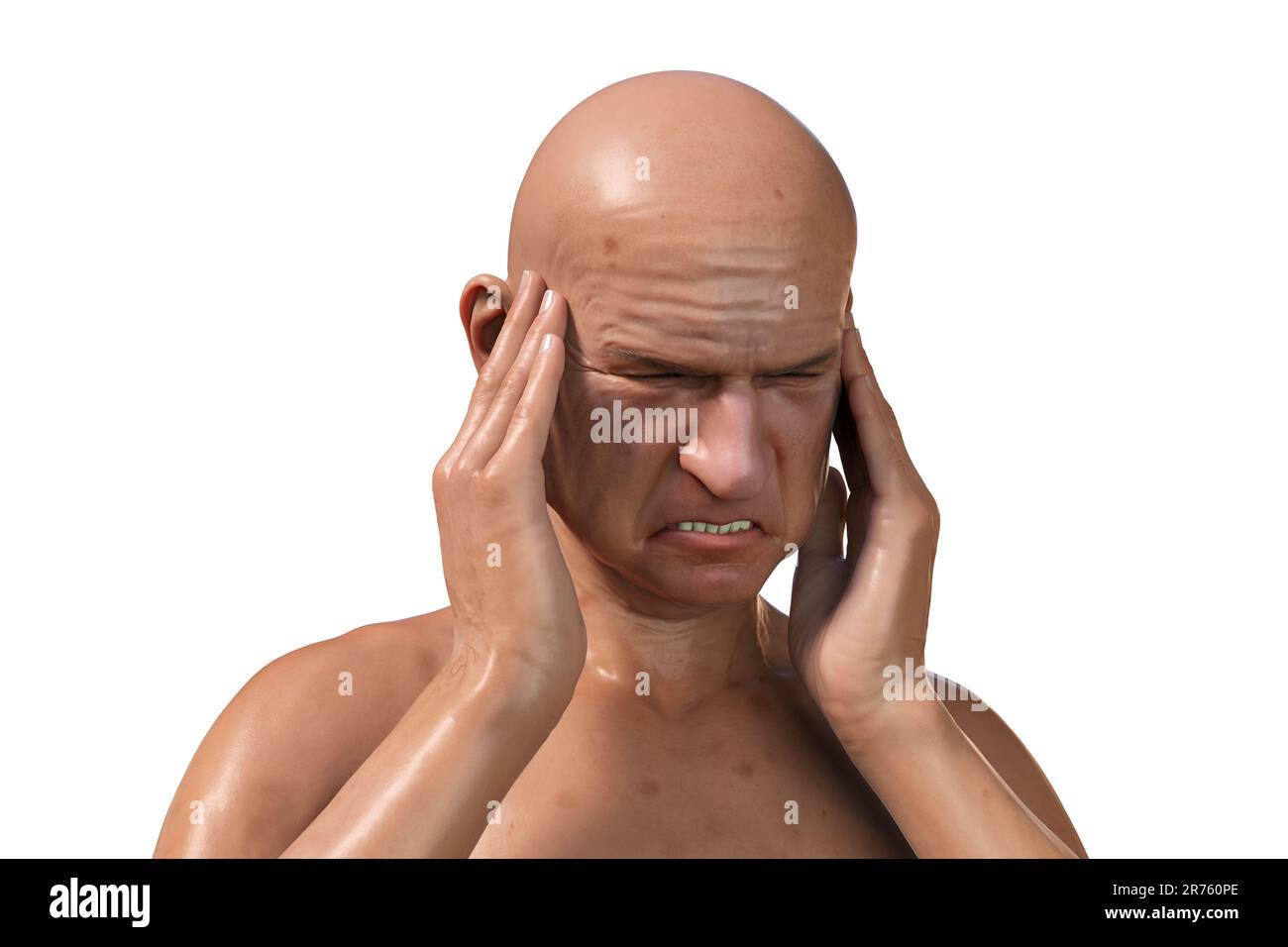 Headache, computer illustration Stock Photo - Alamy