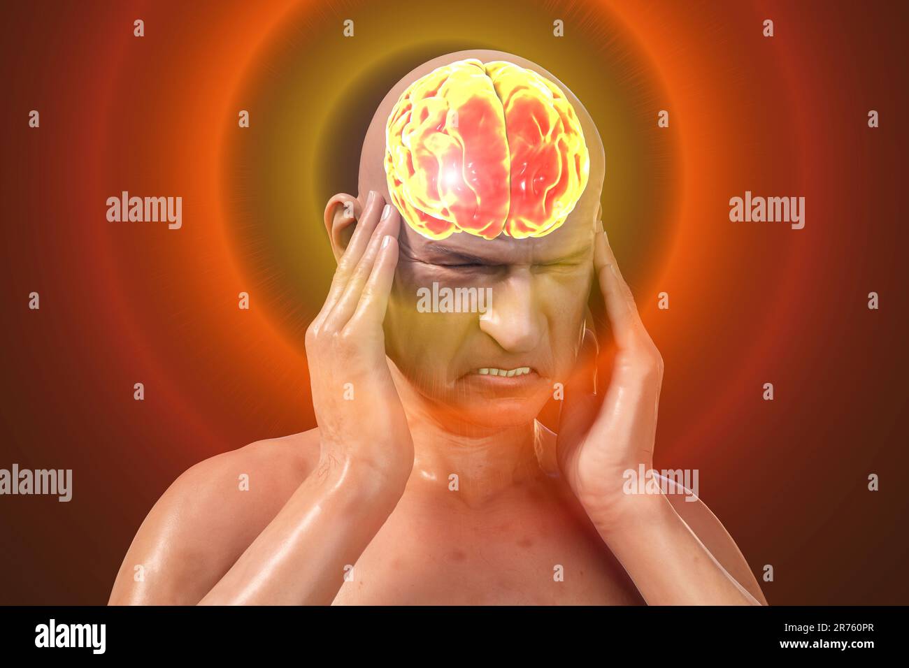 Headache, computer illustration Stock Photo - Alamy