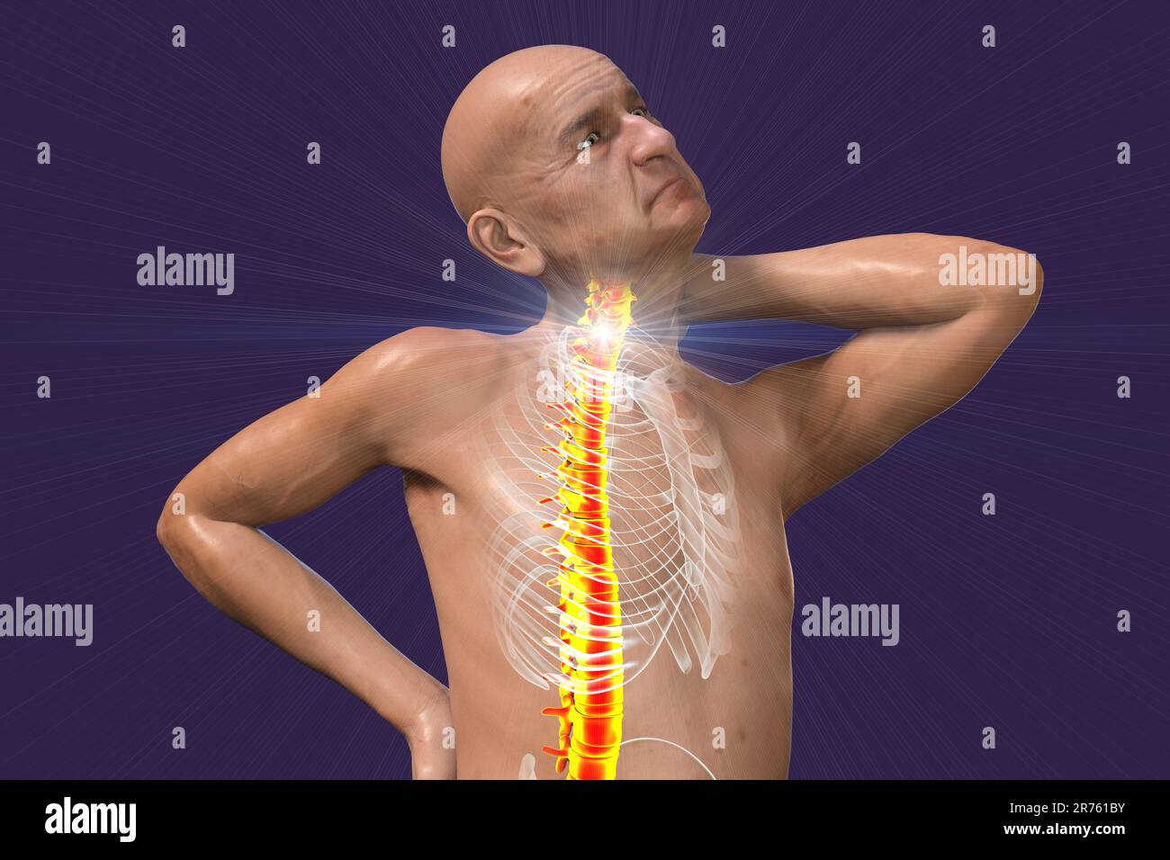 Human neck pain, computer artwork Stock Photo - Alamy