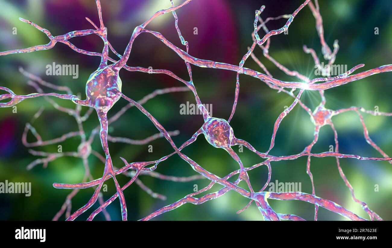 Neurons of the dorsal striatum, computer illustration. Dorsal striatum ...
