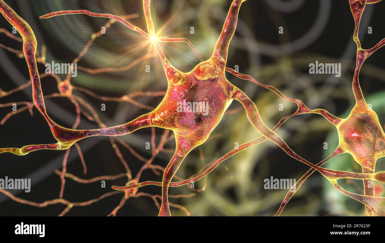 Neurons of the dorsal striatum, computer illustration. Dorsal striatum ...