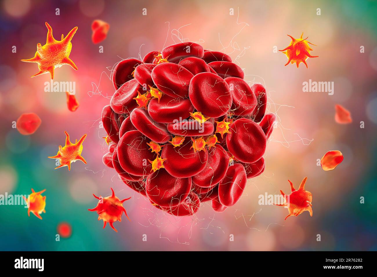 Blood clot, computer artwork Stock Photo - Alamy